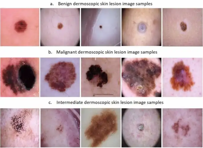 A promising AI based super resolution image recons... - AINave