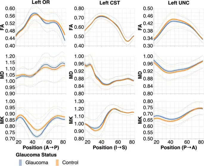 Convolutional Neural Network Based Classification Ainave