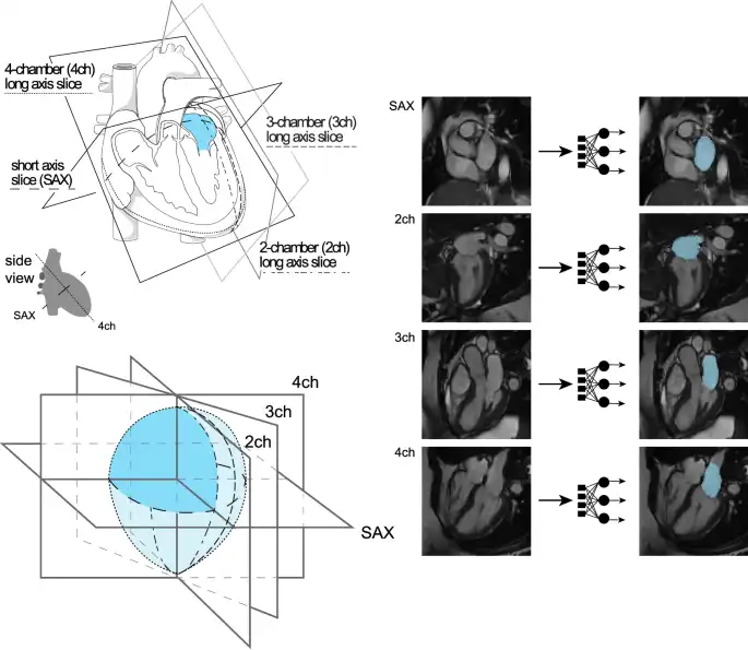 Deep Learning Of Left Atrial Structure And Functio Ainave