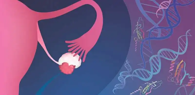 Ovarian Cancer: Early Detection with AI-Aided Biom... - AINave