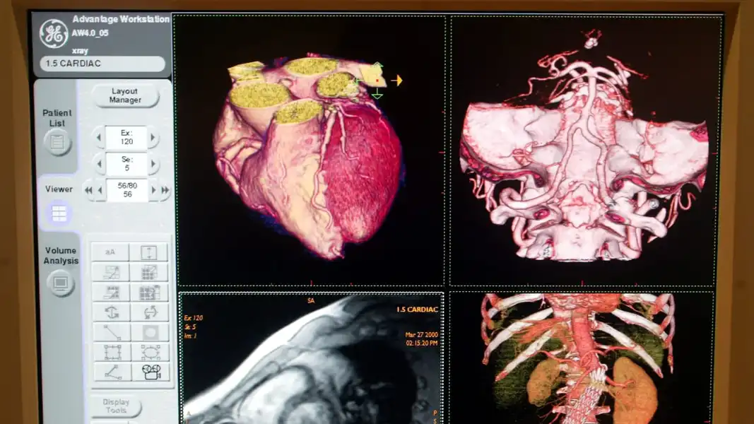 Revolutionizing Diagnostics: How AI is Transformin... - AINave